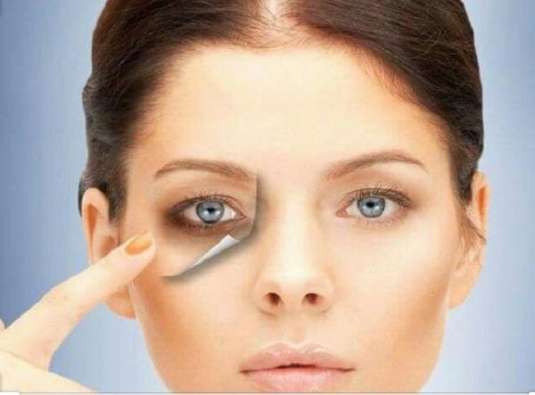 CARBOXYTHERAPY ΠΡΟΣΩΠΟΥ (ΜΑΥΡΟΙ ΚΥΚΛΟΙ) – SKINLAB Dr. Constantinos ...